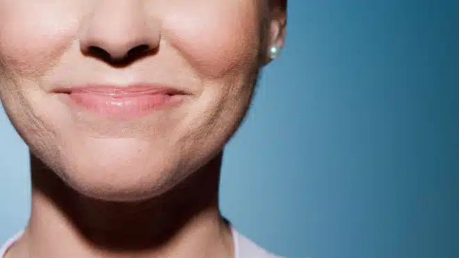 Double Chin Removal: Causes, Prevention, Treatment | Dr. Donath