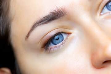 Caring for Eyelid Stitches and Incisions After Blepharoplasty